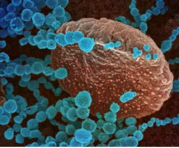 Reinfecção por Covid-19: caso de americano com 2ª vez mais grave ...